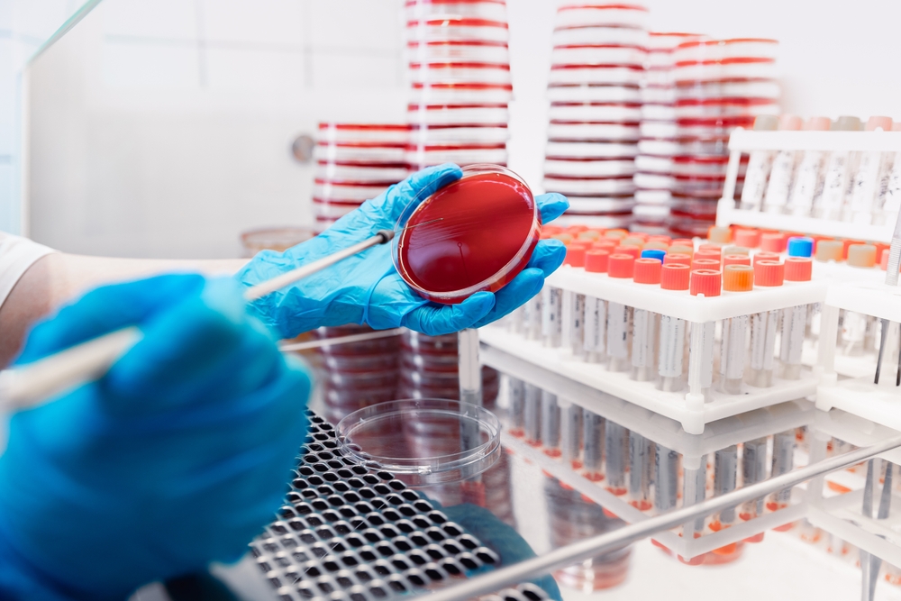 Mi a vérmérgezés - szepszis? Milyen tünetei vannak, hogyan zajlik ...